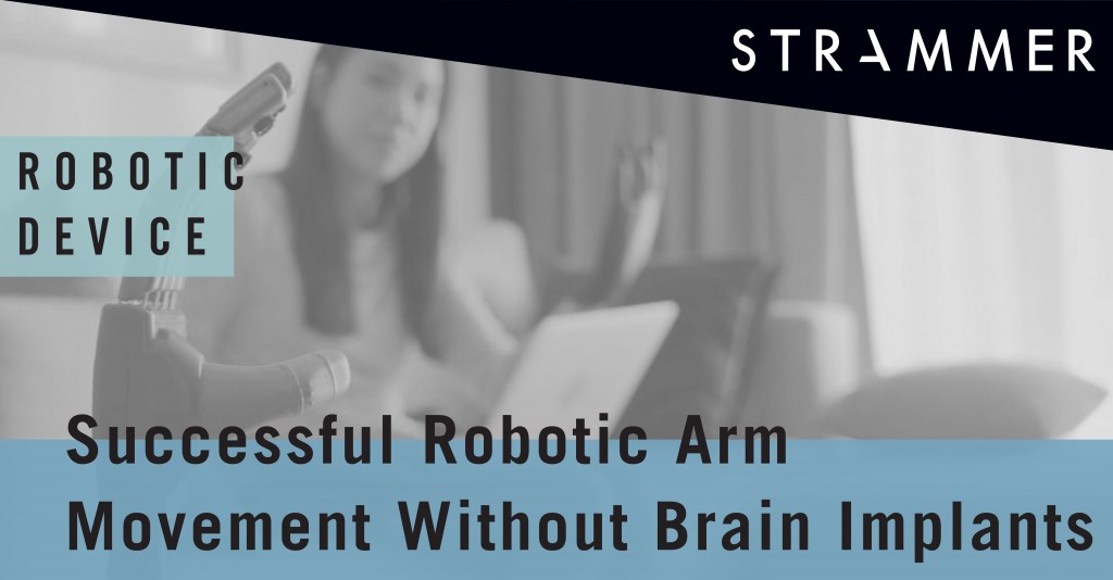 Mind Controlled Robotic Arm Impresses Specialists - Strammer
